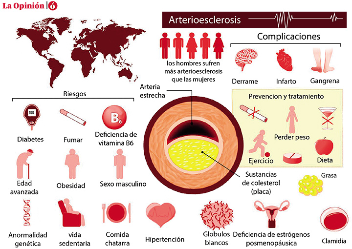 Arterosclerosis, enemigo de cuidado para tus arterias